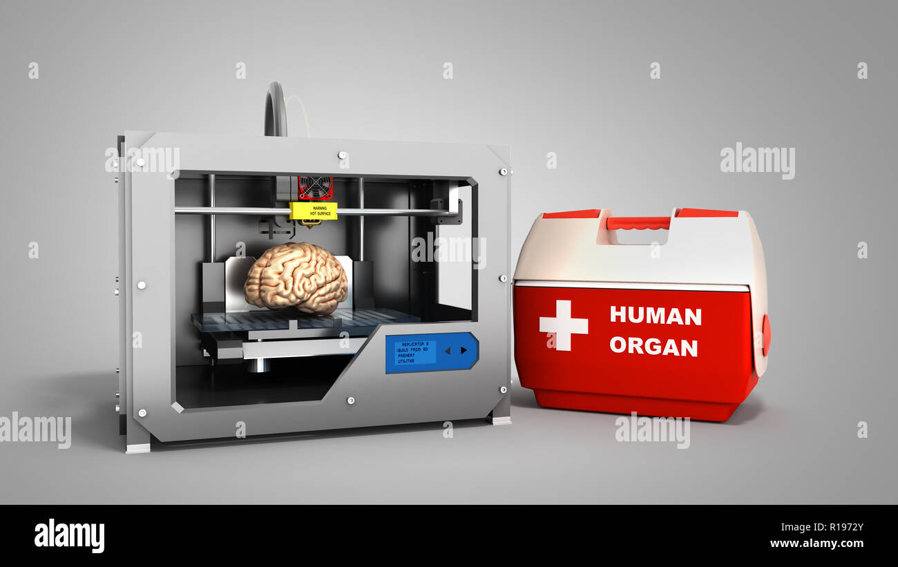 concept of transplantation process of creating human brain using 3D ...