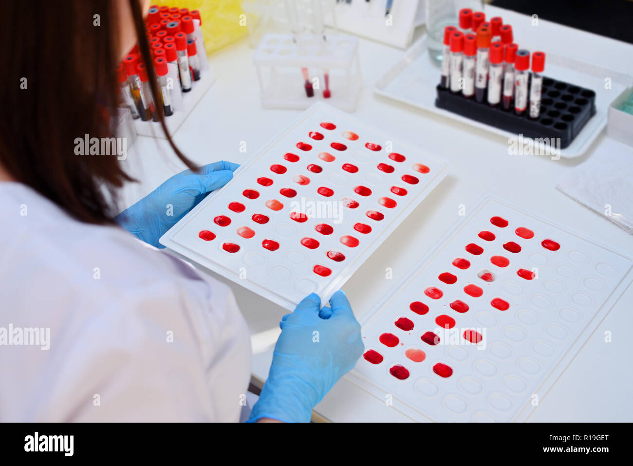 Blood test cancer hi-res stock photography and images - Alamy