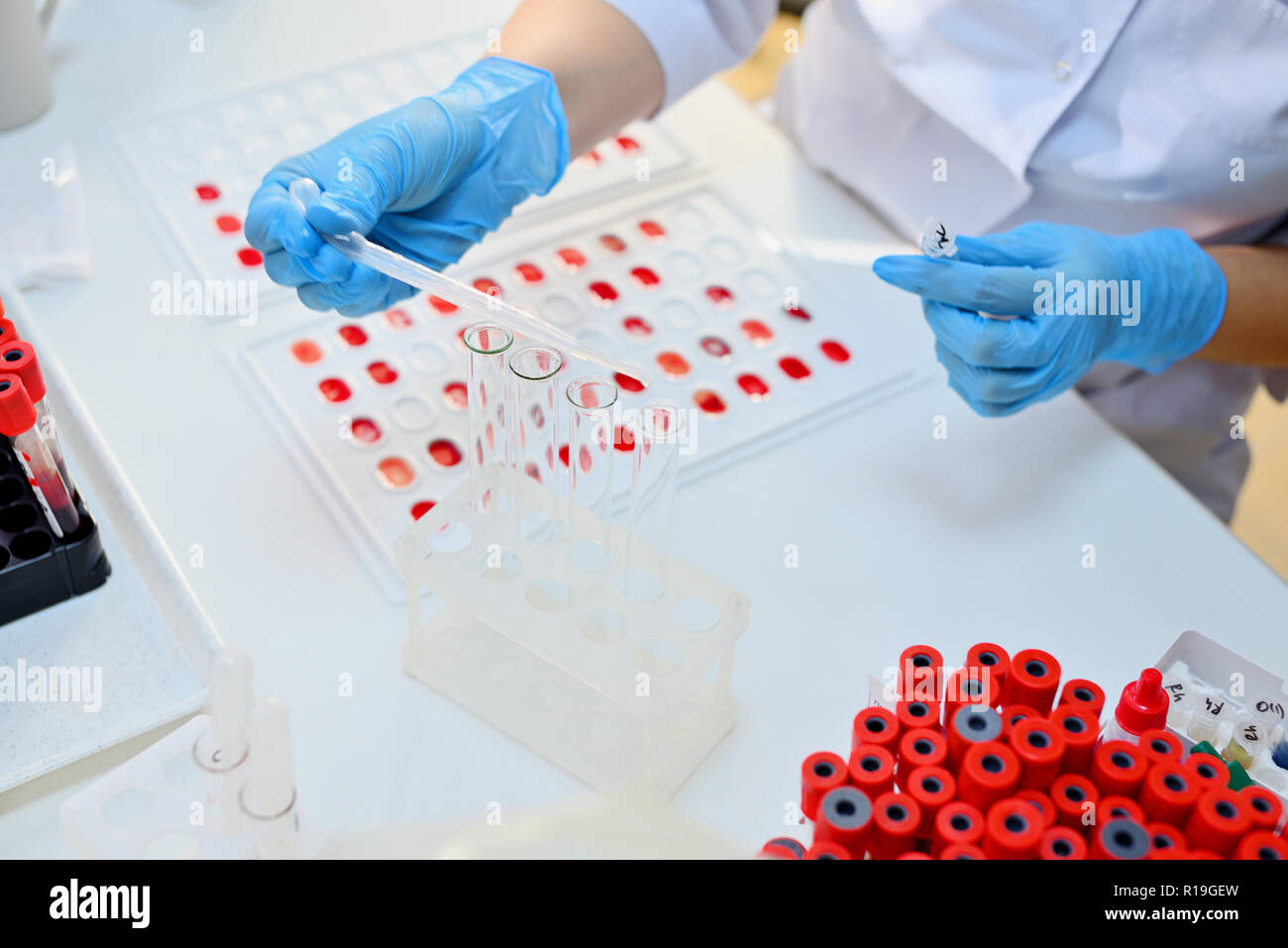 Laboratory determination of blood type. Blood test Stock Photo - Alamy