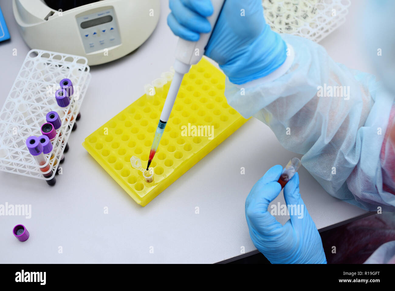 Dna test in the lab. Dispenser with blood and test tubes close-up. A ...