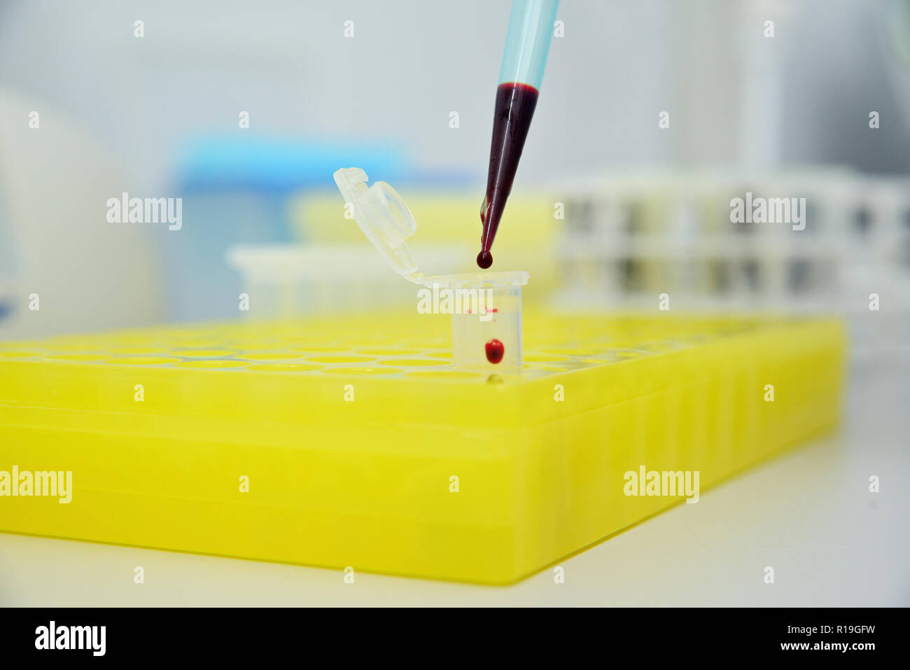 Dna test in the lab. Dispenser with blood and test tubes close-up. A ...
