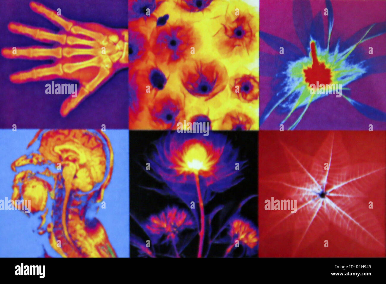 The opening of 'The Beauty of Imaging' exhibit that celebrates the ...