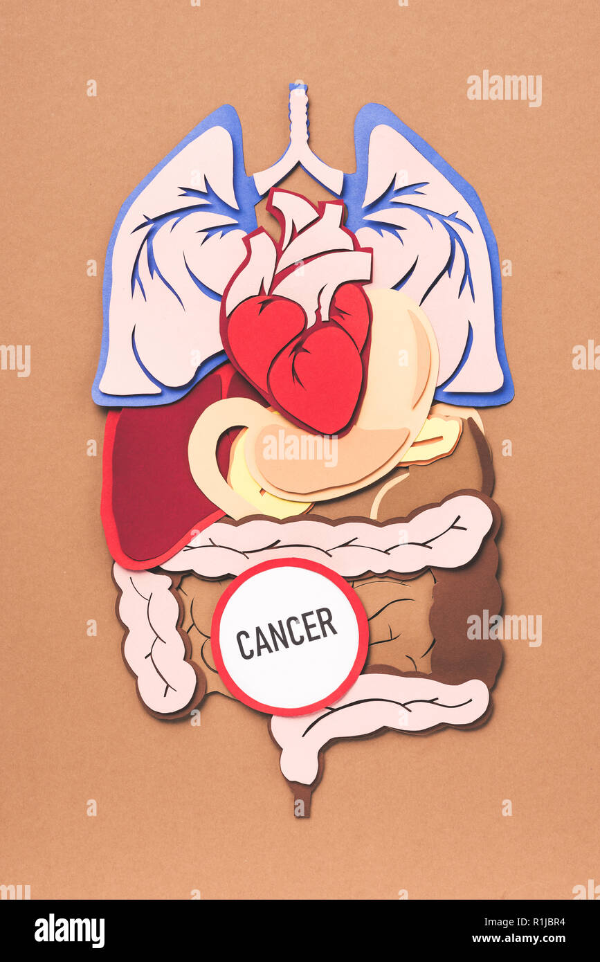 flat lay with human internal organs and lettering cancer on brown Stock ...