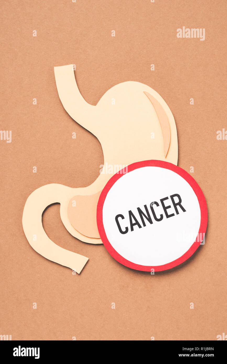 view from above of human stomach and lettering cancer on beige Stock ...