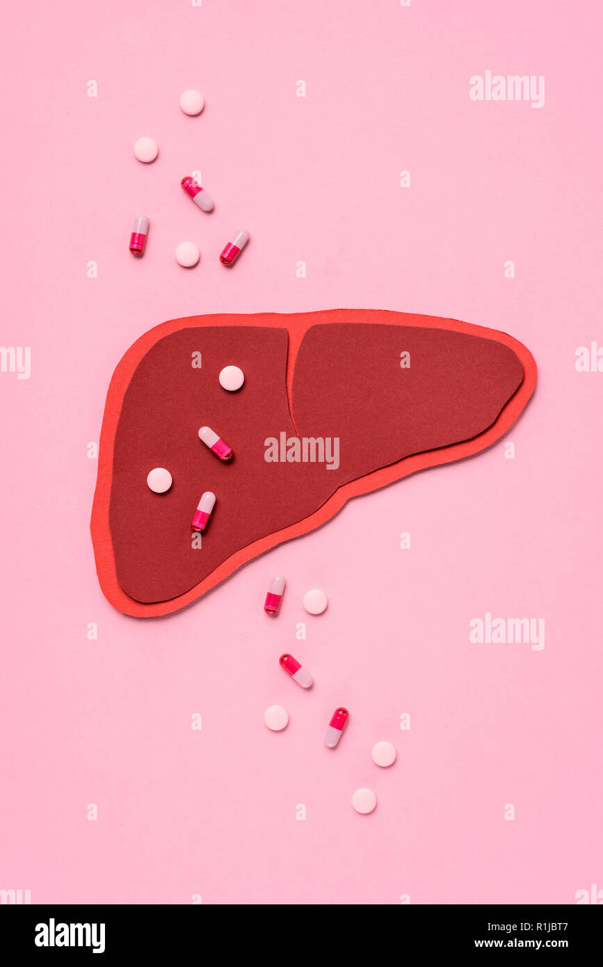 Liver carcinoma hi-res stock photography and images - Alamy