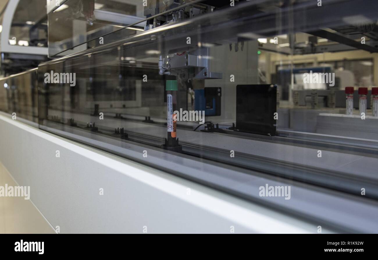 A blood sample is processed through a Siemens fully automated robotic ...