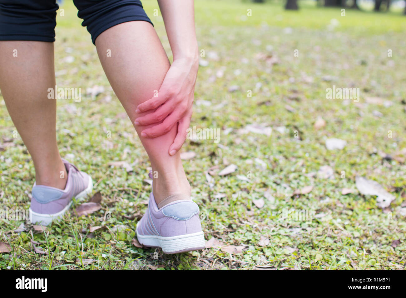 Woman pain leg runner hi-res stock photography and images - Alamy