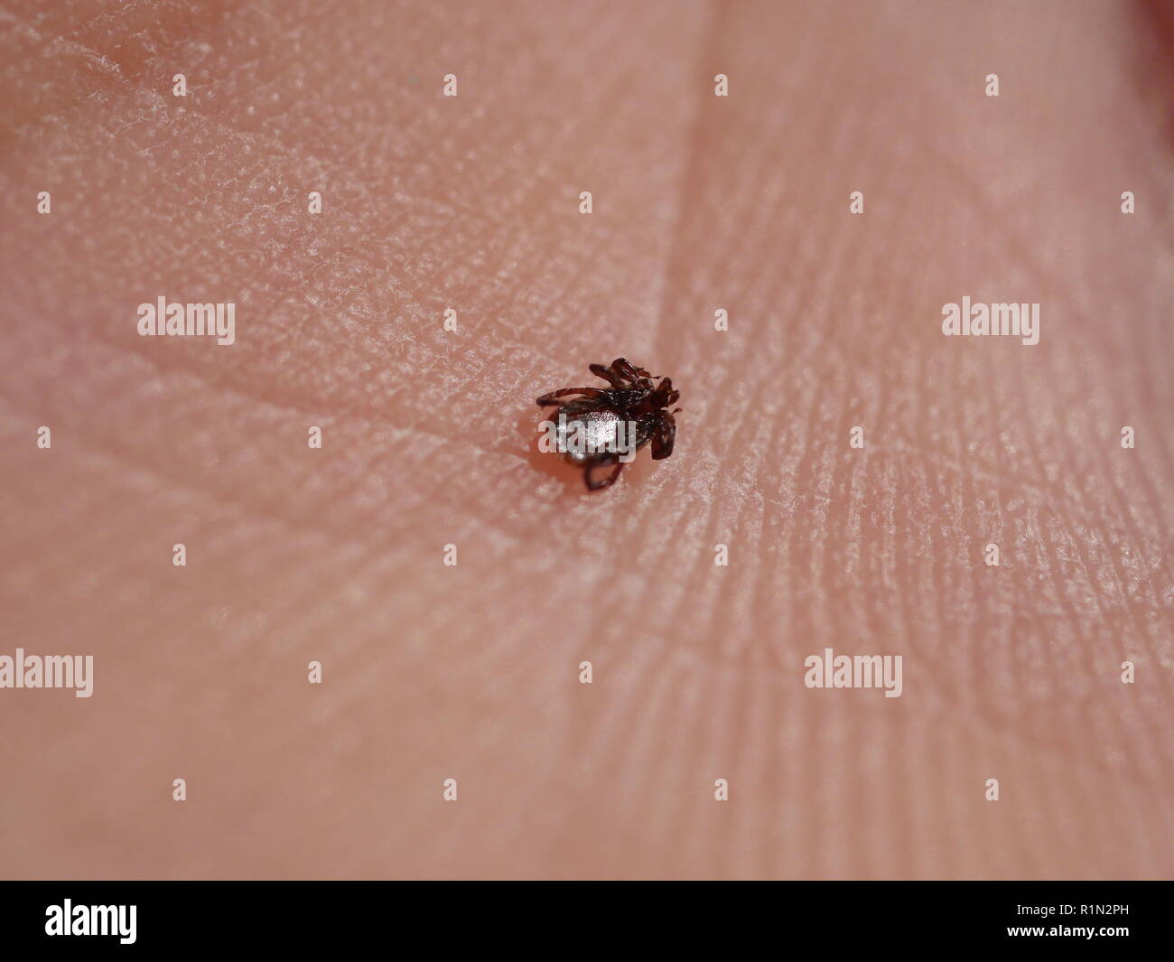 Tick on hand hi-res stock photography and images - Alamy
