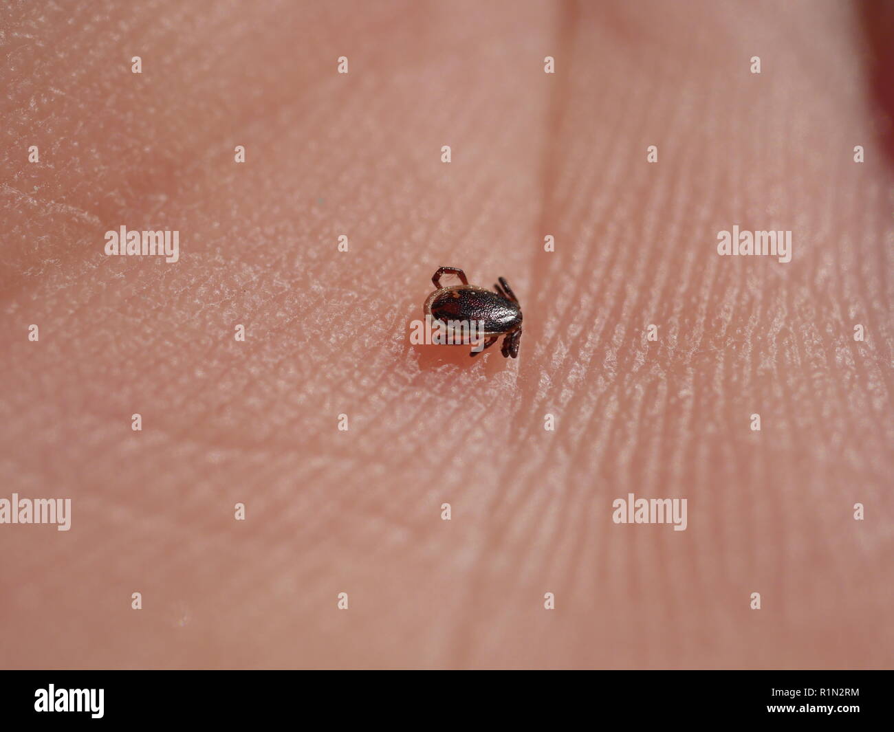 dangerous tick on hand Stock Photo - Alamy