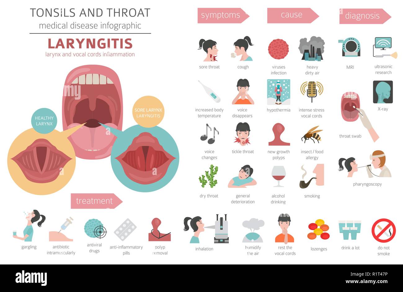 Tonsils and throat diseases. Laryngitis symptoms, treatment icon set ...