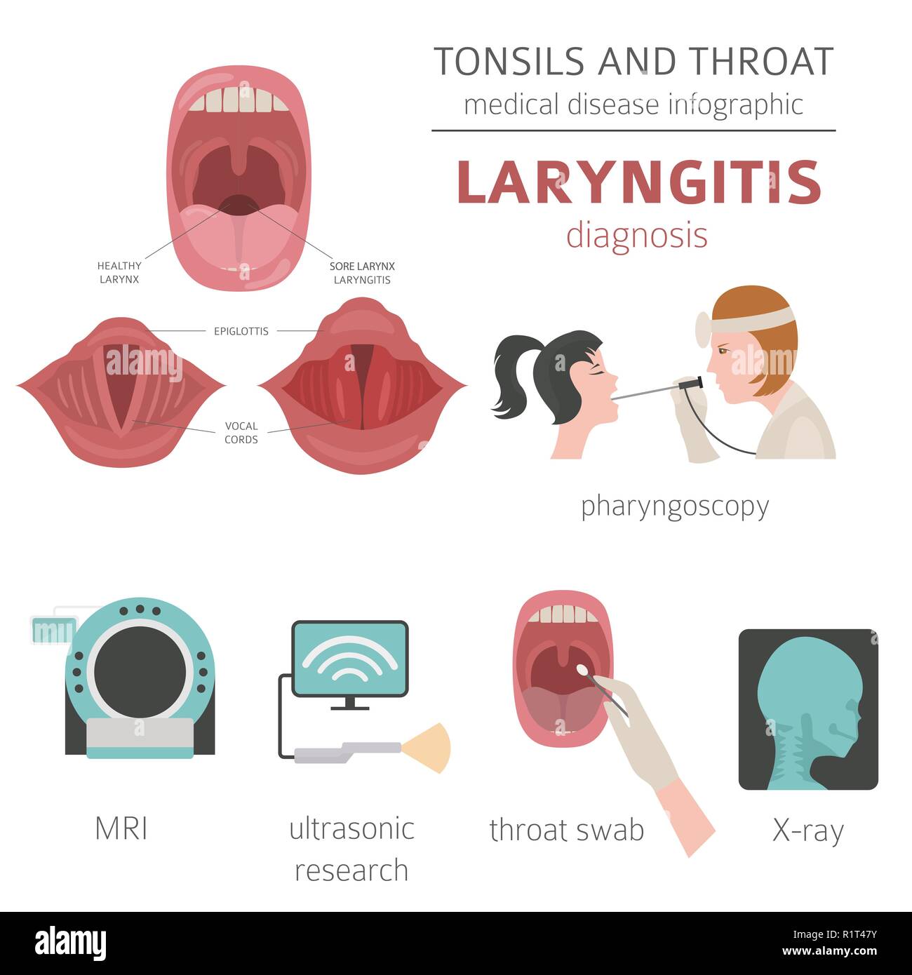 Tonsils and throat diseases. Laryngitis symptoms, treatment icon set ...