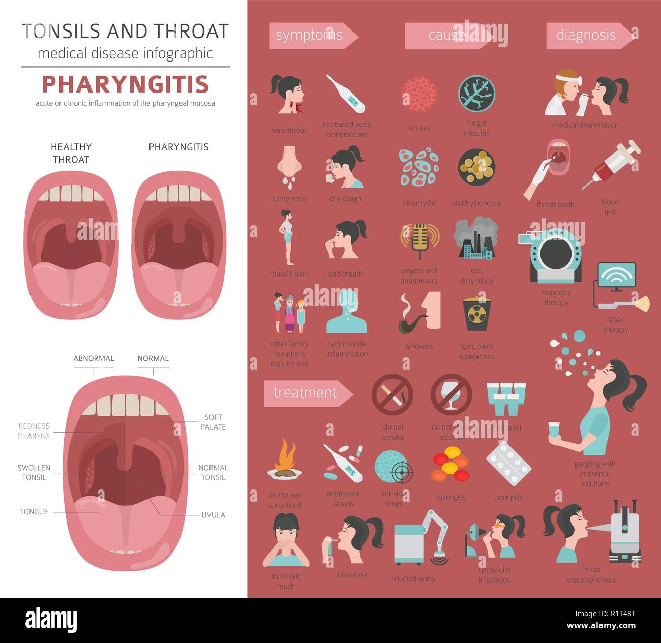 Tonsils and throat diseases. Pharyngitis symptoms, treatment icon set ...
