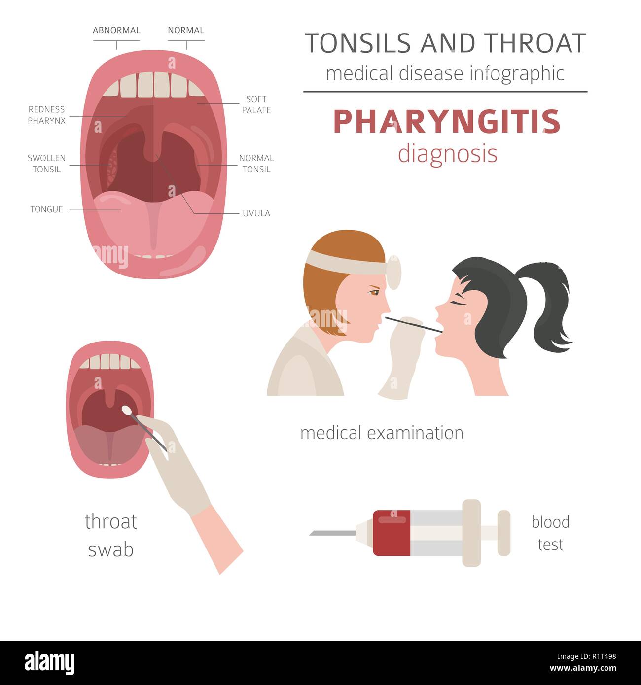 Tonsils and throat diseases. Pharyngitis symptoms, treatment icon set ...