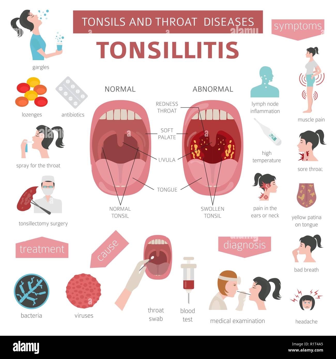 Tonsils and throat diseases. Tonsillitis symptoms, treatment icon set ...