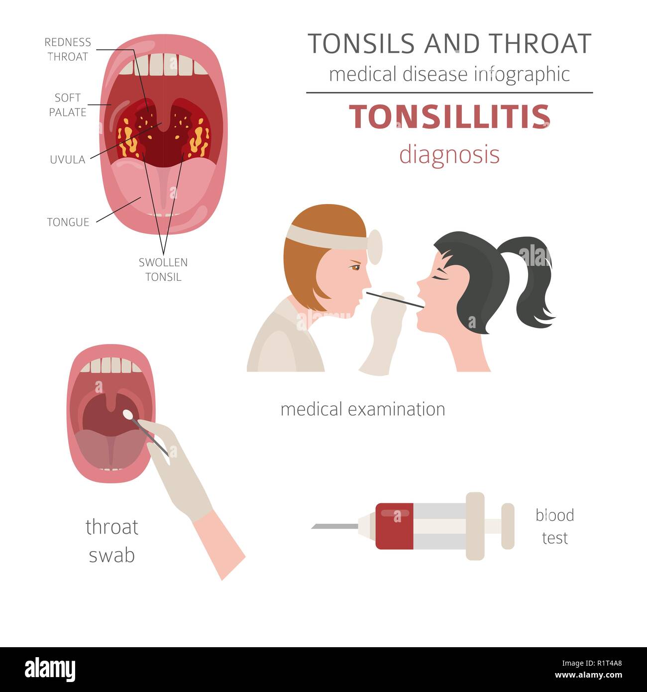 Soft Palate Mouth Stock Photos & Soft Palate Mouth Stock Images - Alamy
