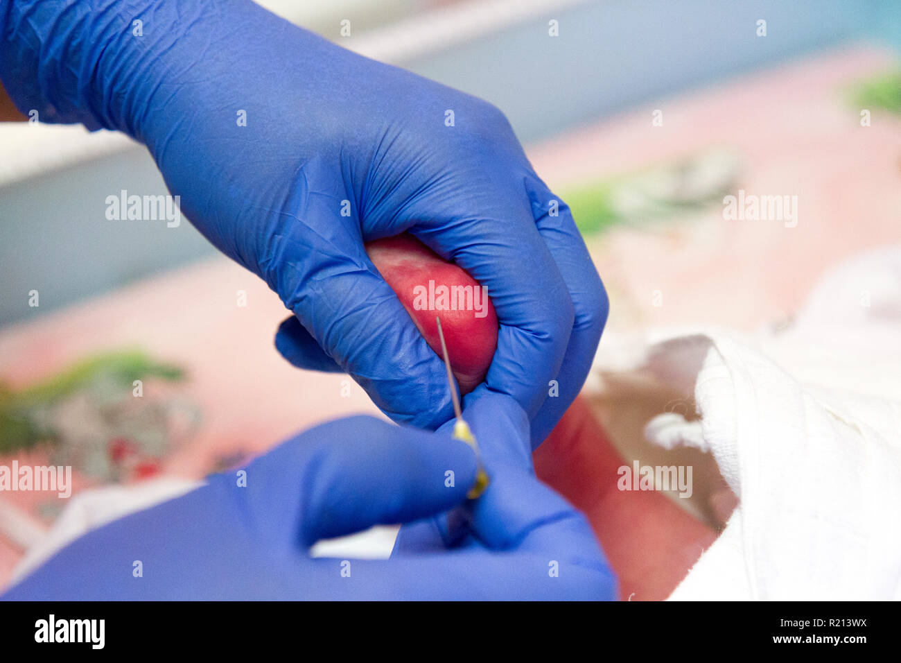 Newborn blood spot (heel prick) test (the Guthrie' test). A physician ...