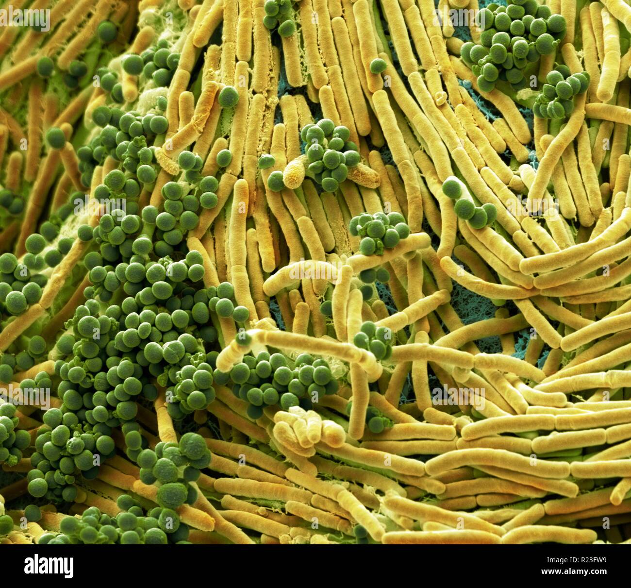 Coloured scanning electron micrograph (SEM) of bacteria cultured from a ...