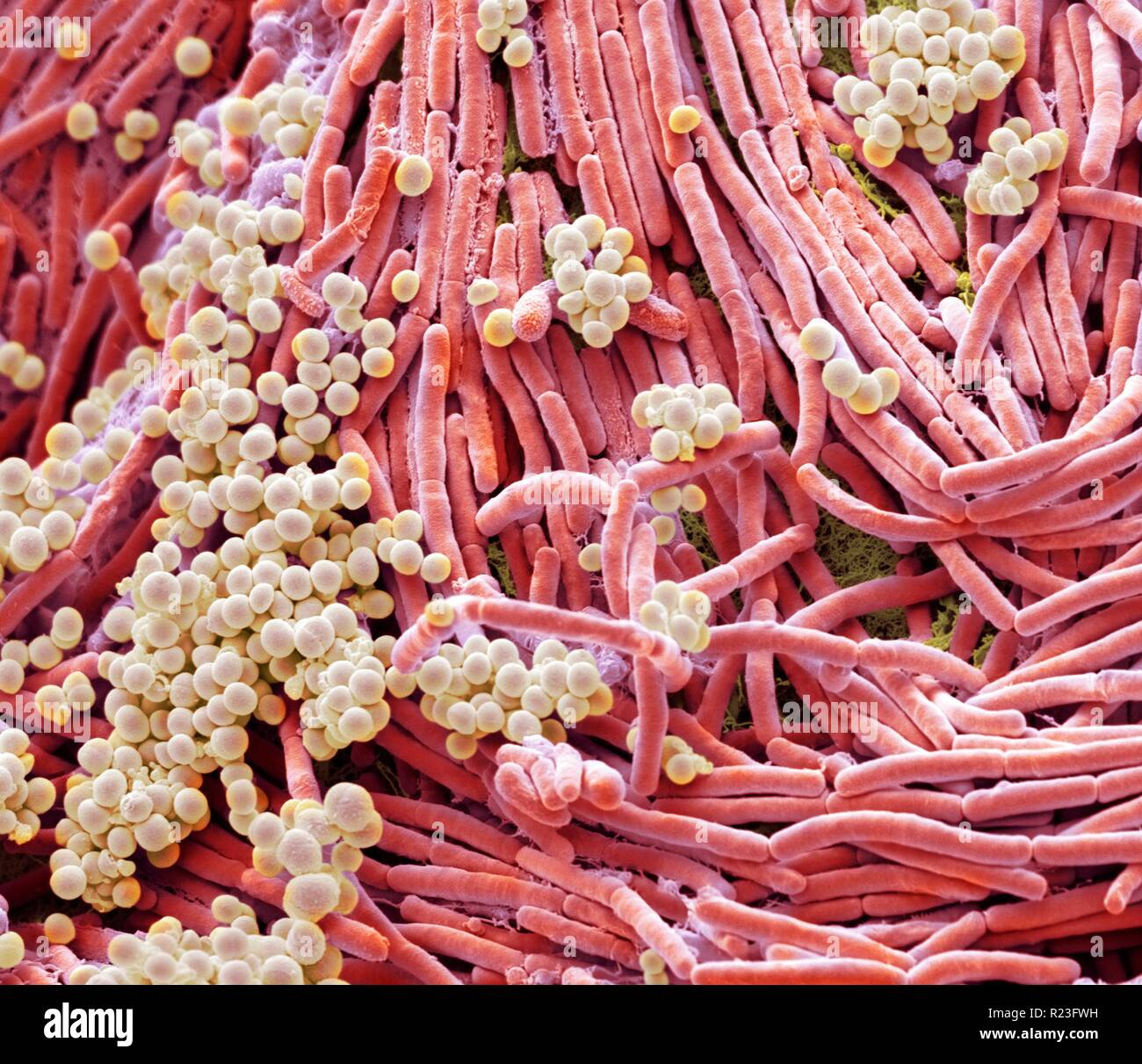 Coloured scanning electron micrograph (SEM) of bacteria cultured from a ...