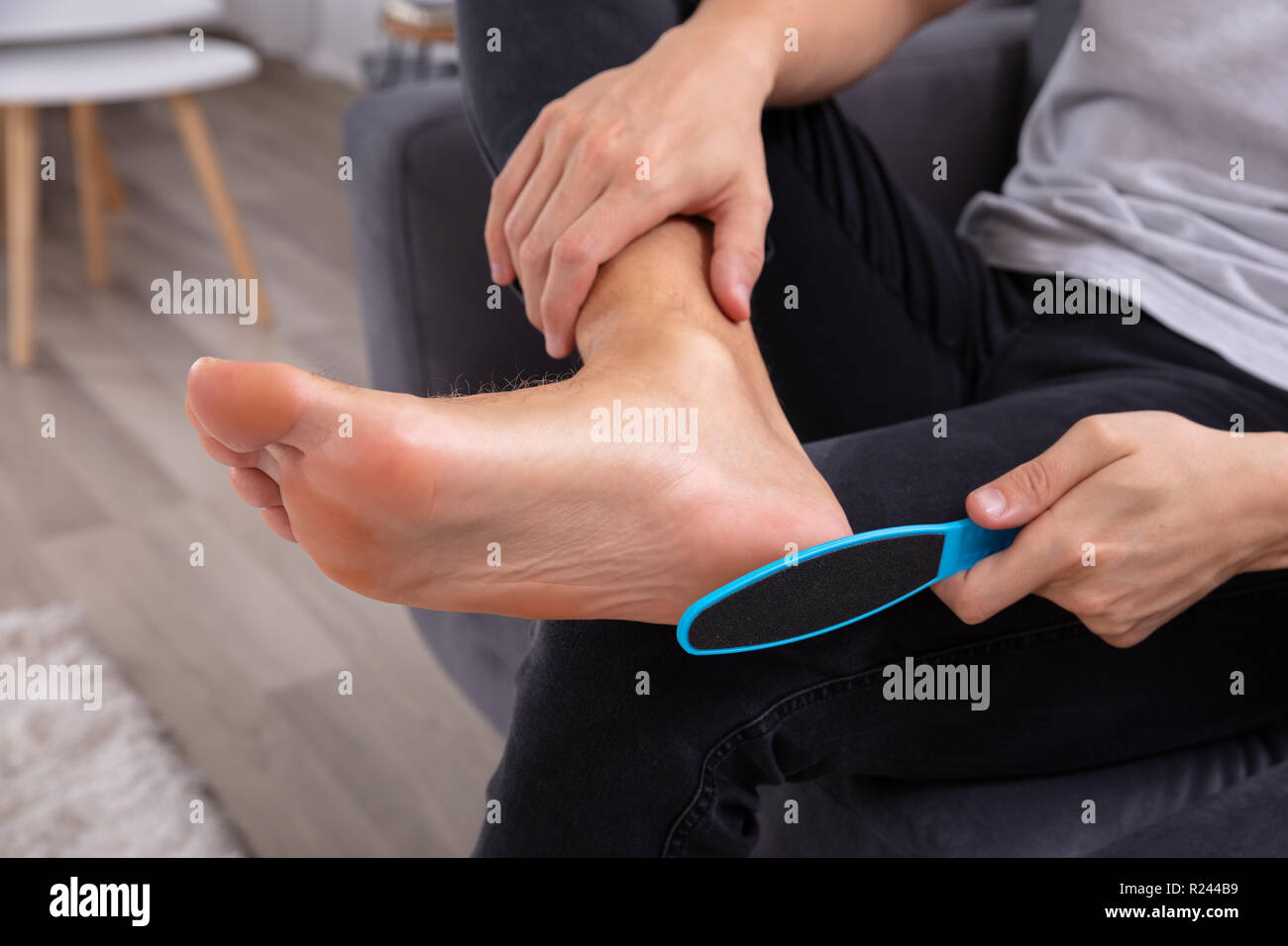Callus feet man hi-res stock photography and images - Alamy