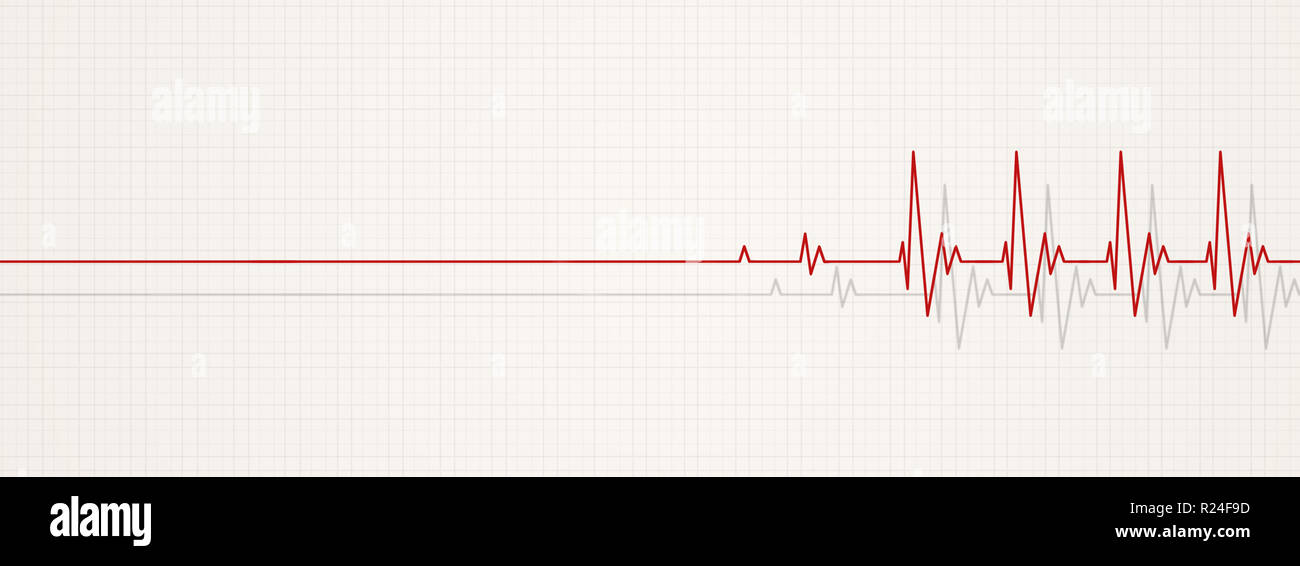 Death ecg hi-res stock photography and images - Alamy