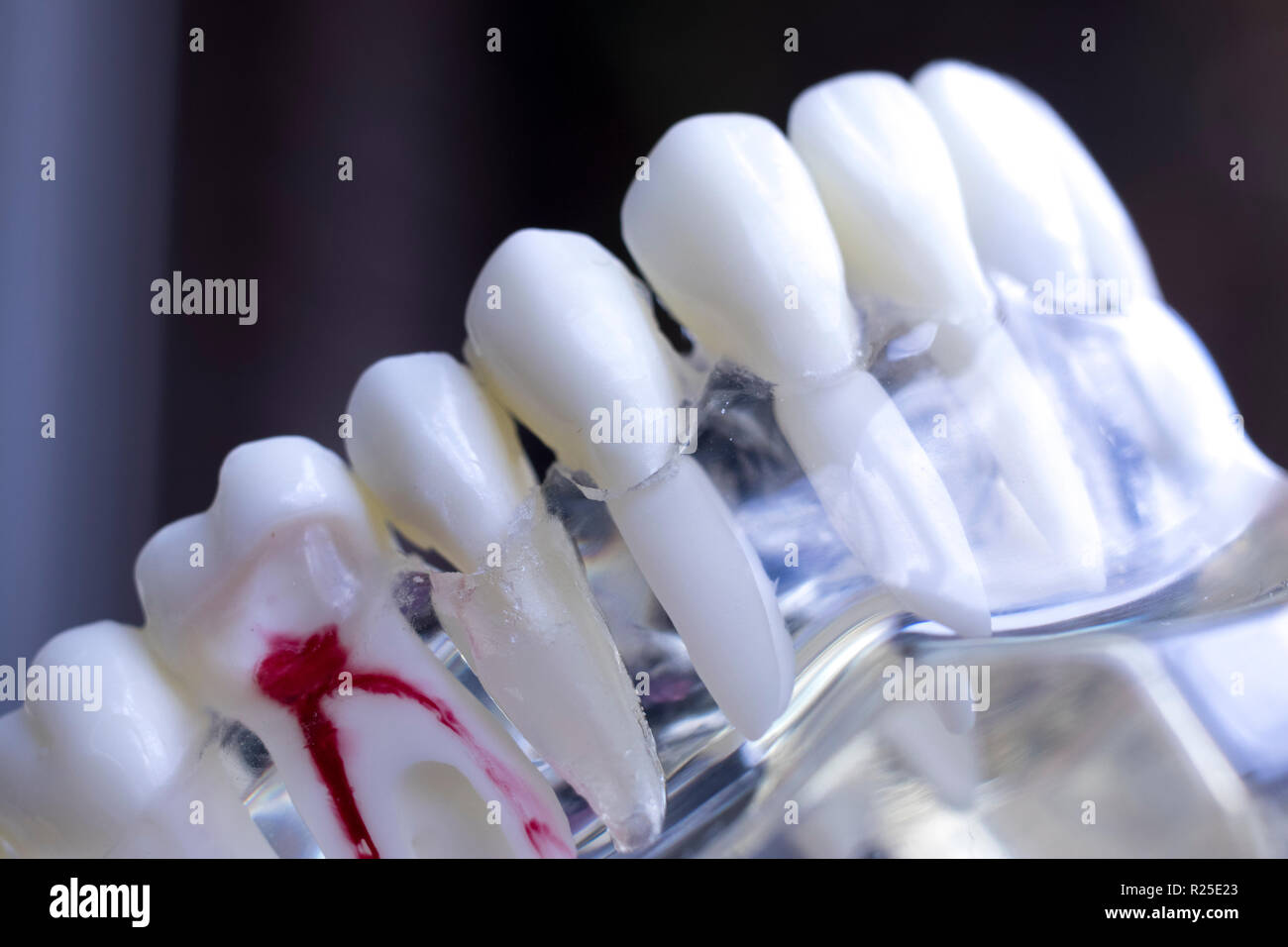 Dentist dental teeth teaching model showing each tooth and gum for ...