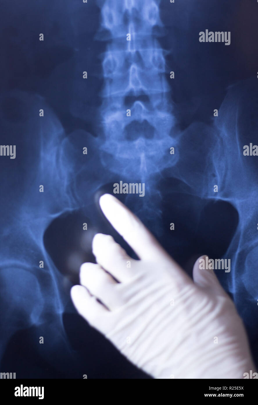 Medical hospital x-ray lowe back pain spine and hips traumatology scan ...