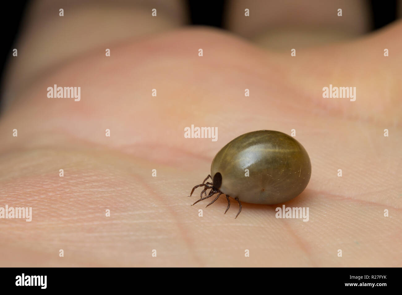 Ticks On Human Skin