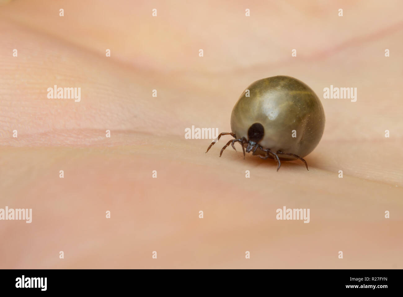 Adult tick on the human skin surface Stock Photo - Alamy