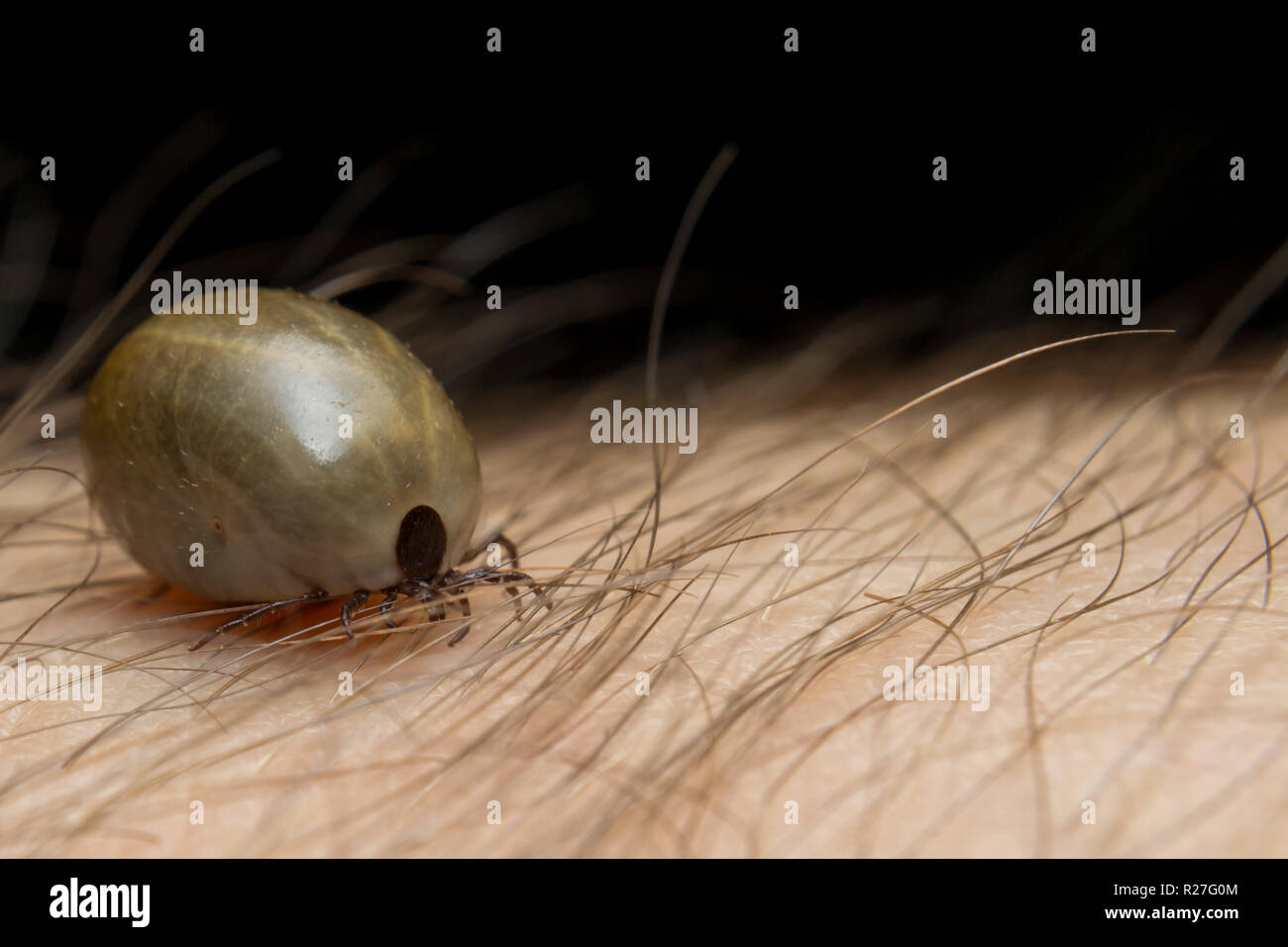 Adult tick on the human skin surface Stock Photo - Alamy
