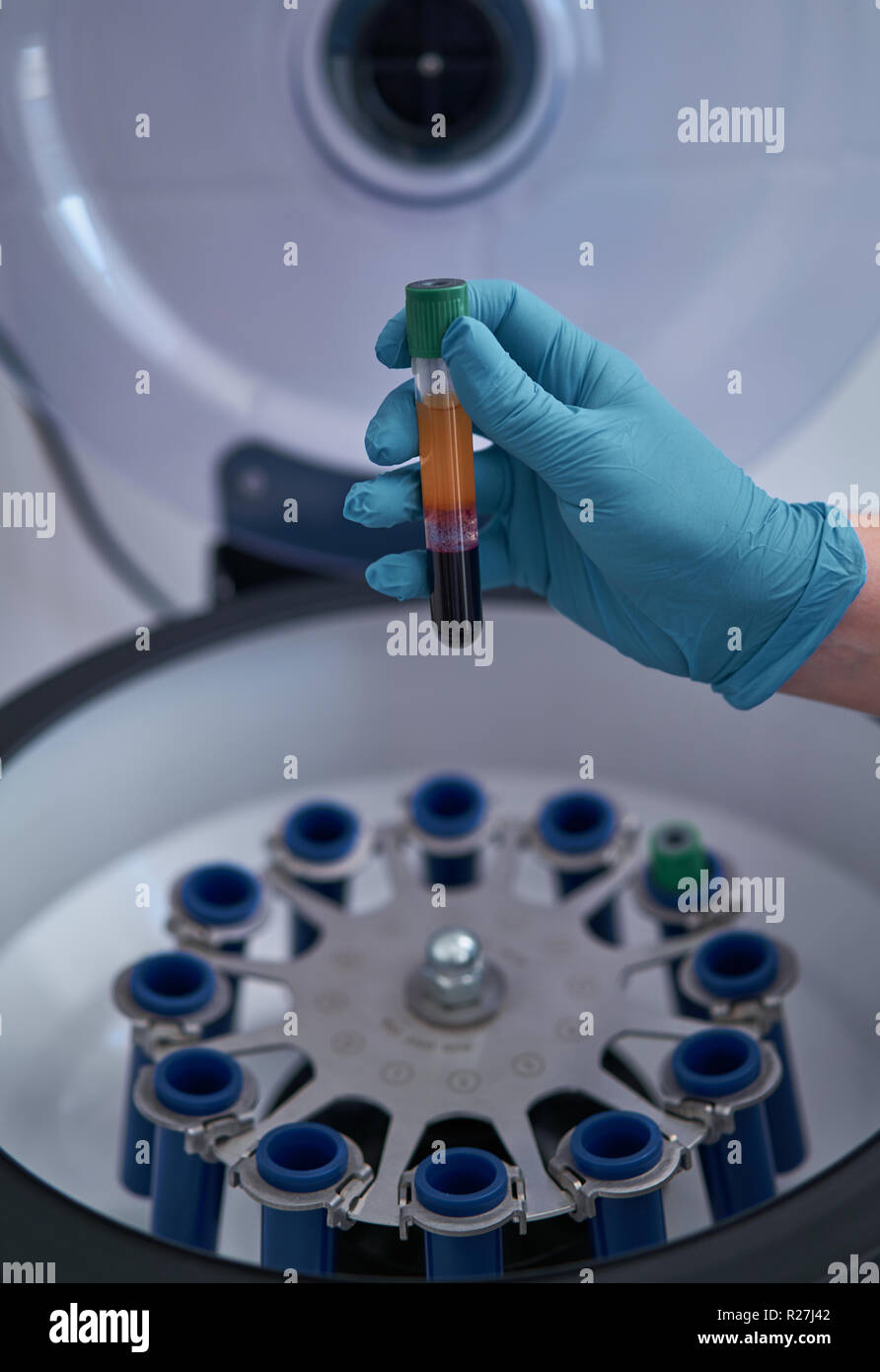 medical test tube Stock Photo - Alamy