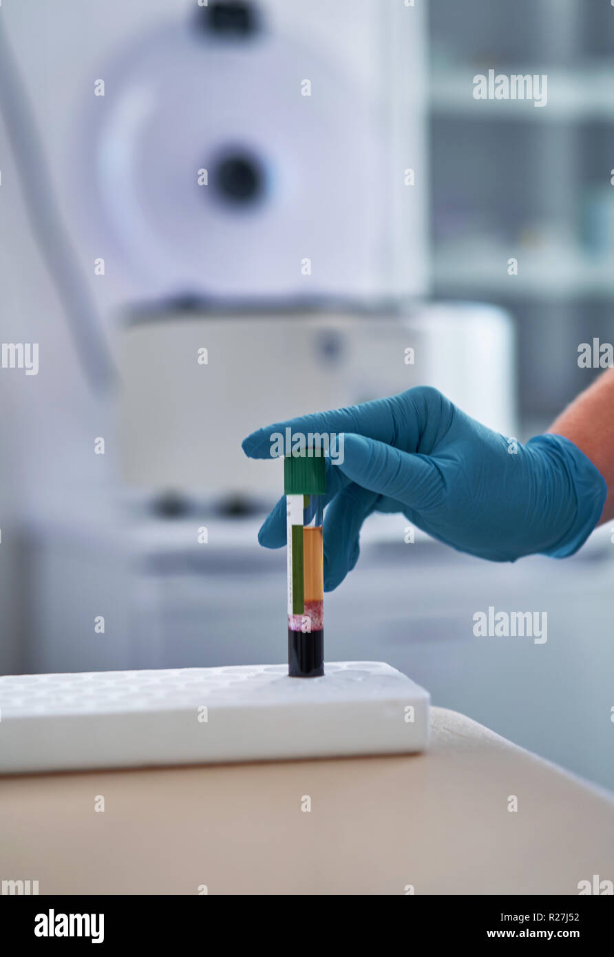 medical test tube Stock Photo - Alamy