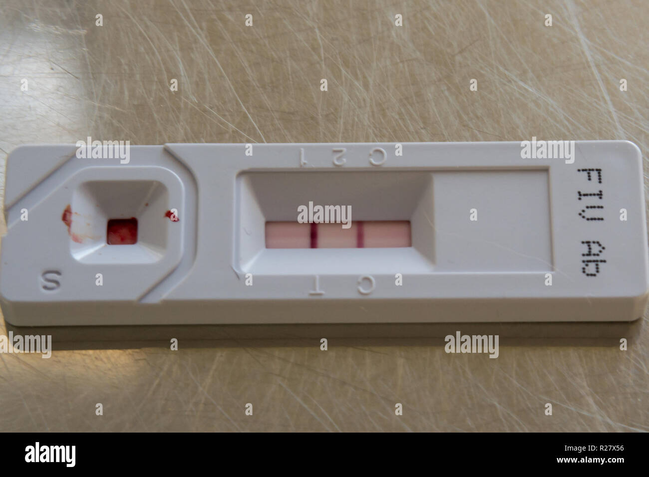 Positiv rapid test. Two red lines Stock Photo - Alamy