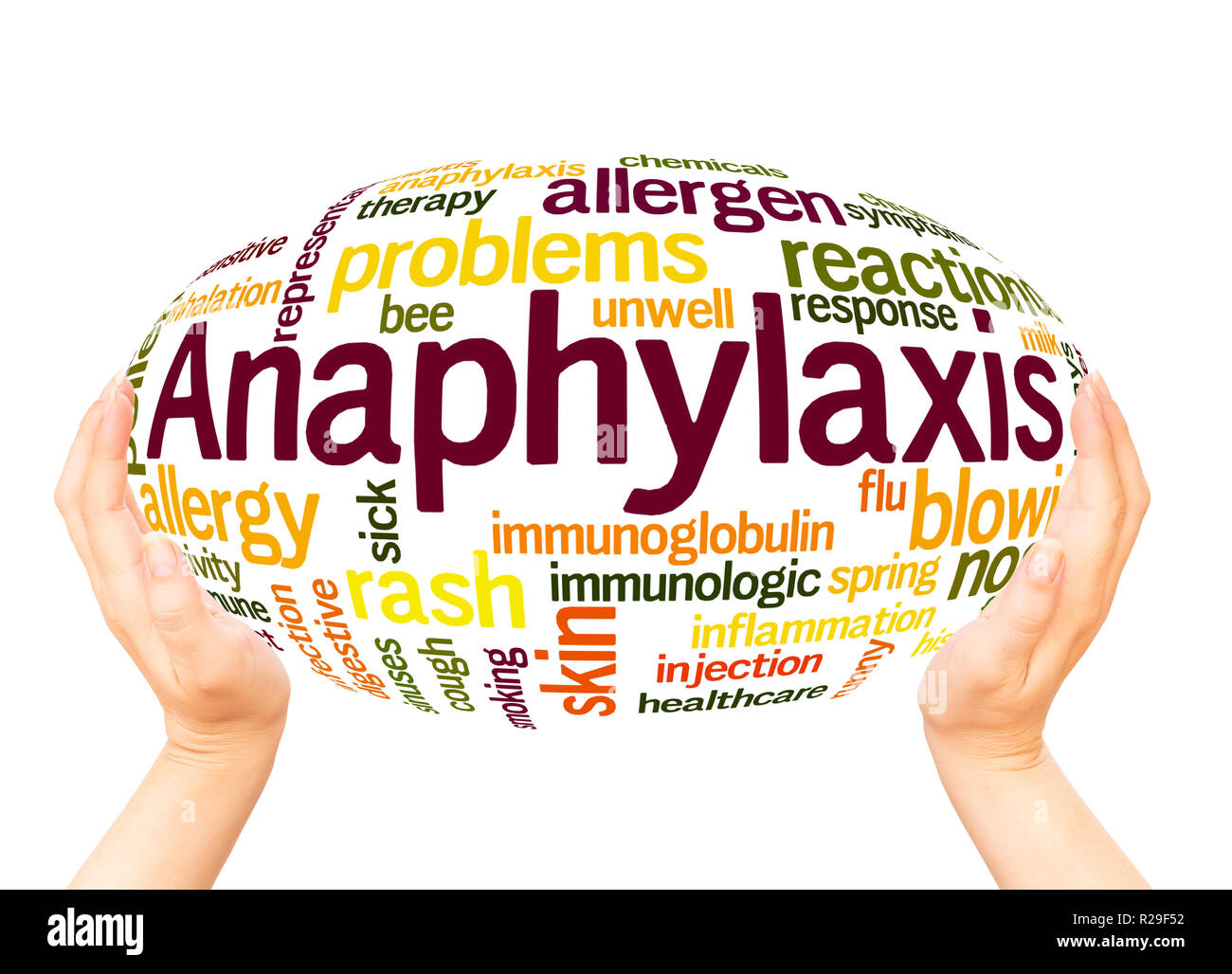 Anaphylaxis word cloud hand sphere concept on white background Stock ...