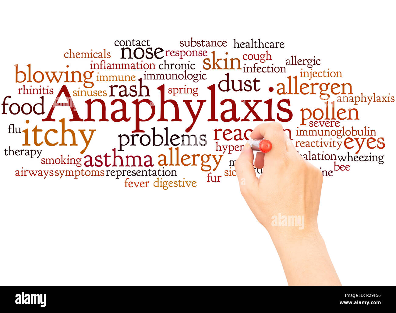 Anaphylaxis rash Cut Out Stock Images & Pictures - Alamy