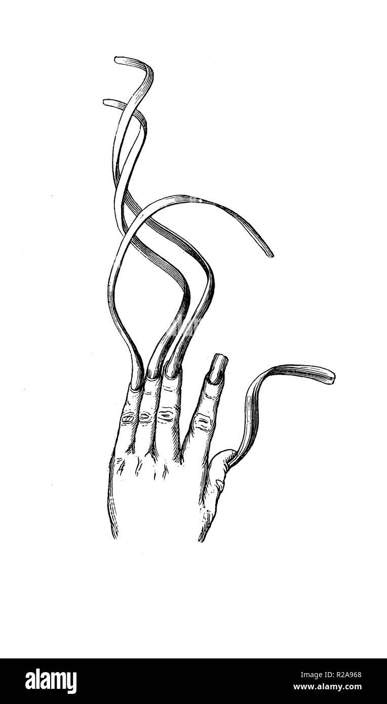 Abnormal hi-res stock photography and images - Alamy