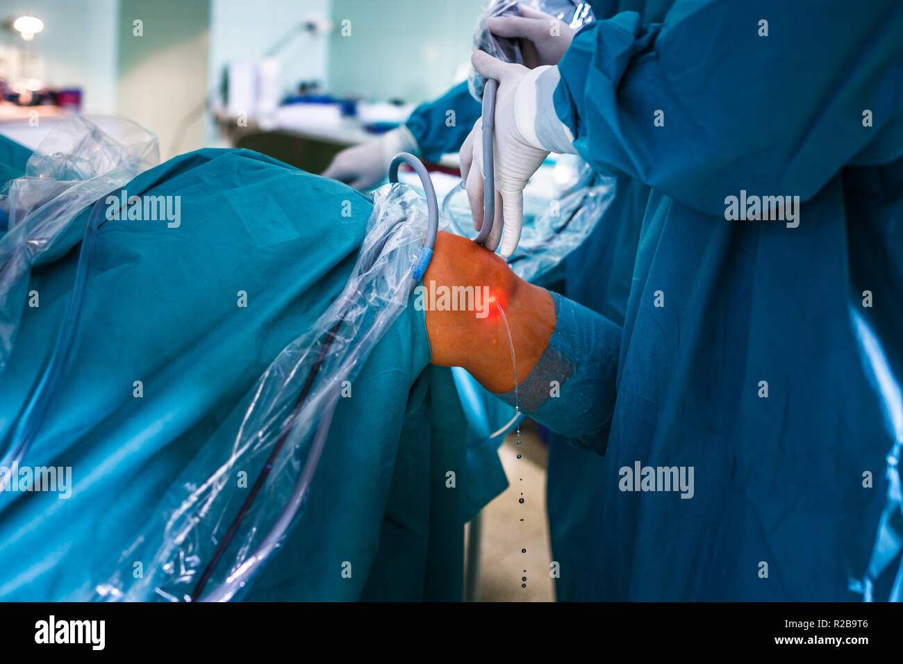 Knee surgery, Orthopedic Operation - two surgeons performing a knee ...