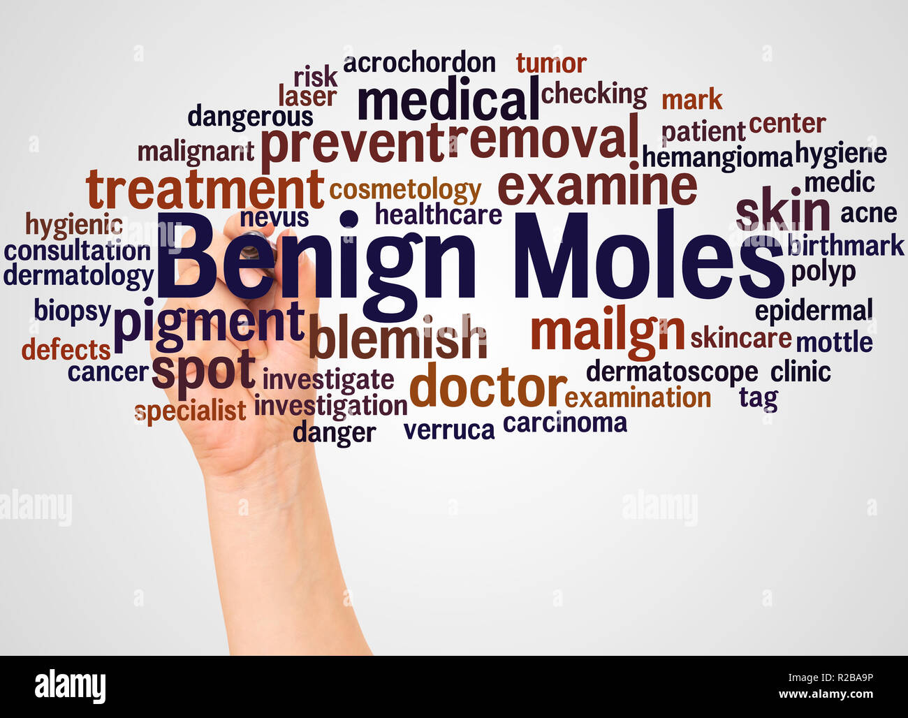 Benign Moles word cloud and hand with marker concept on white ...