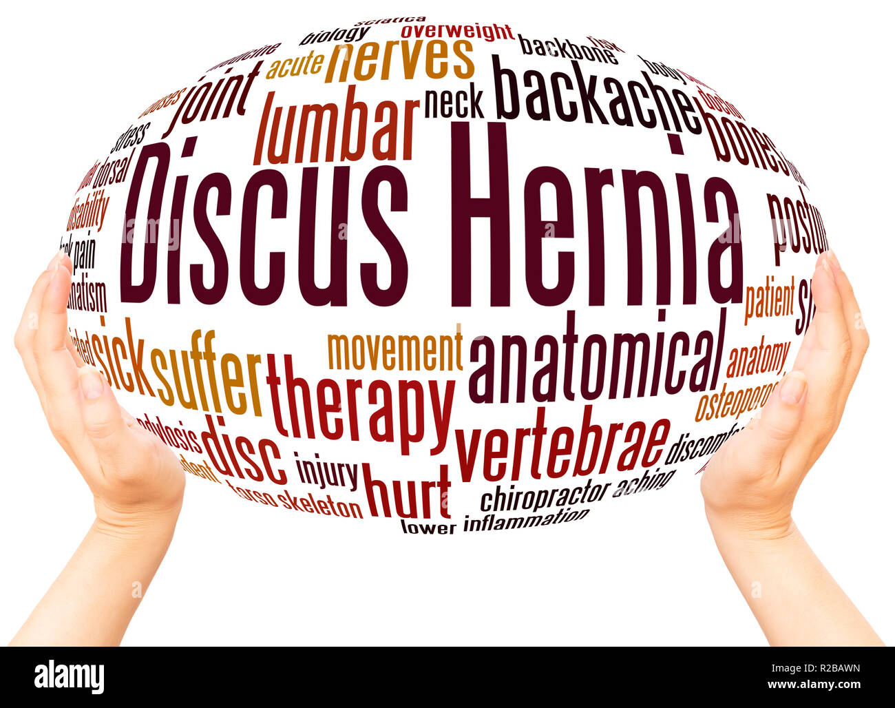Discus Hernia word cloud hand sphere concept on white background Stock ...