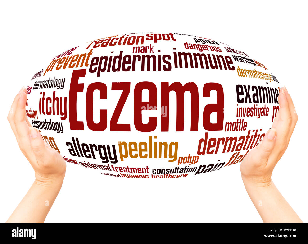 Eczema word cloud hand sphere concept on white background Stock Photo ...