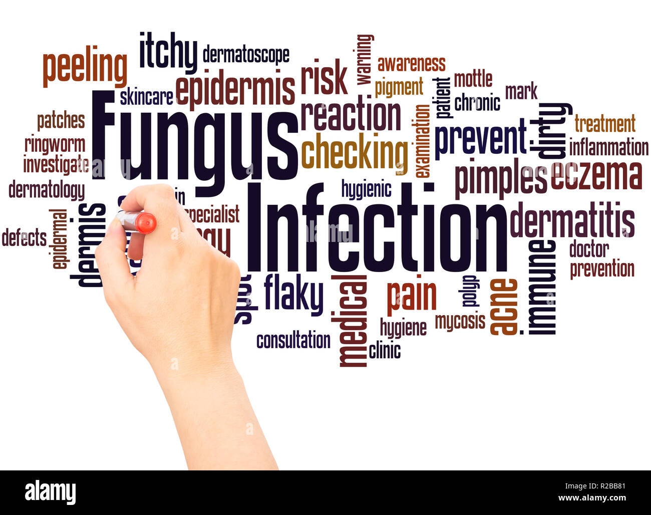 Fungus Infection word cloud hand writing concept on white background ...