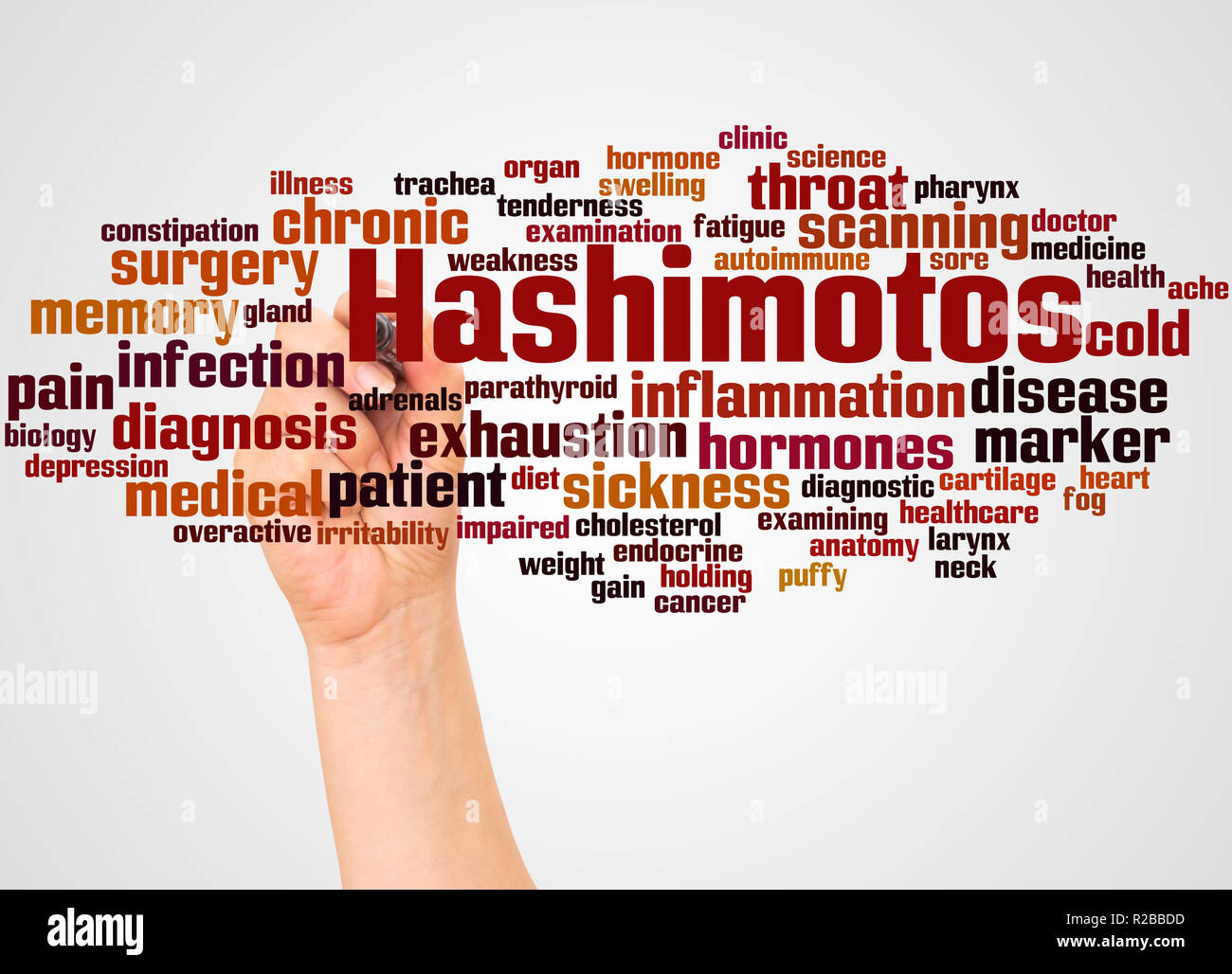 Hashimotos word cloud and hand with marker concept on white background ...