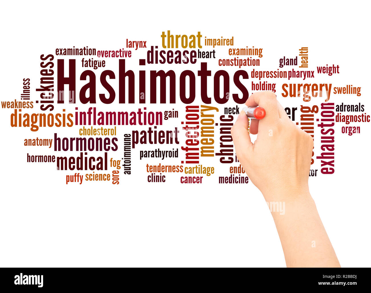 Hashimotos word cloud hand writing concept on white background Stock ...