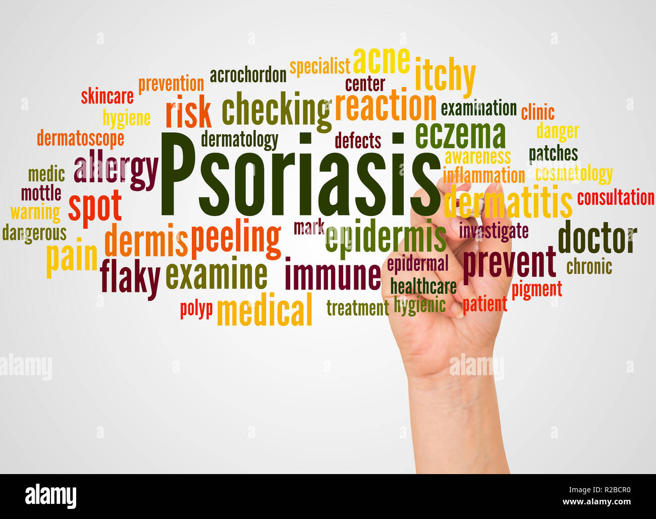 Psoriasis word cloud and hand with marker concept on white background ...