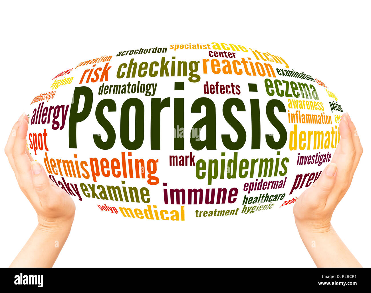 Psoriasis word cloud hand sphere concept on white background Stock ...