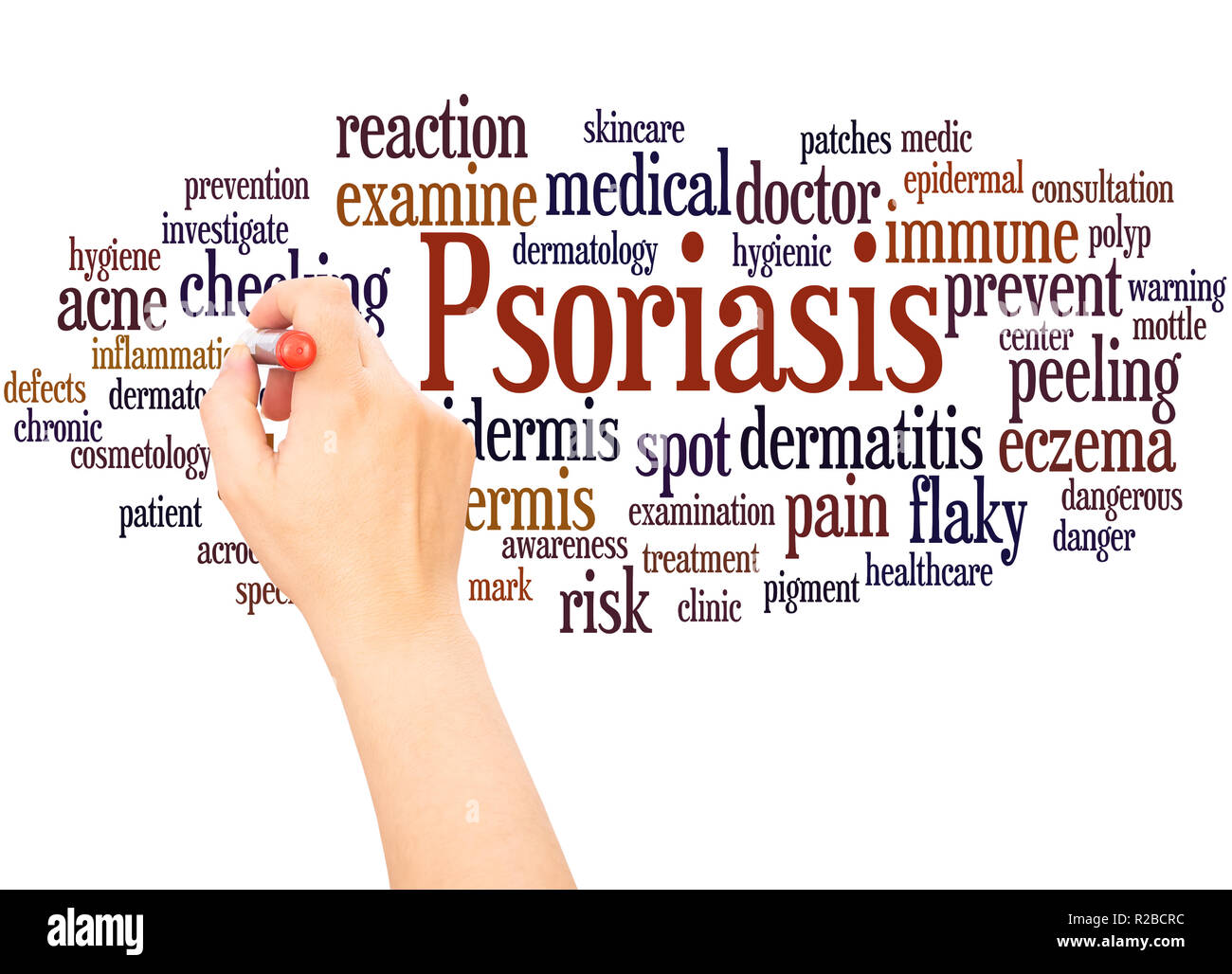 Psoriasis word cloud hand writing concept on white background Stock ...