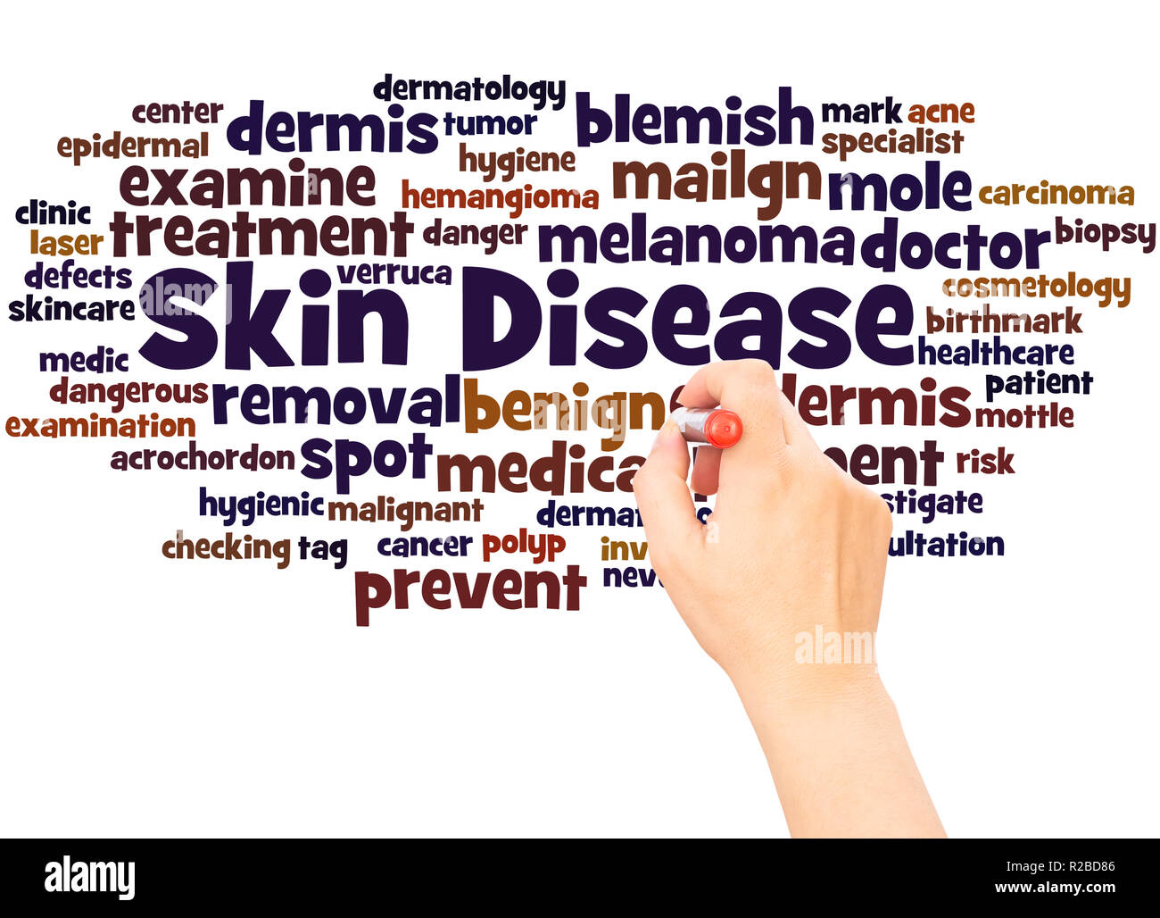 Skin Disease word cloud hand writing concept on white background Stock ...