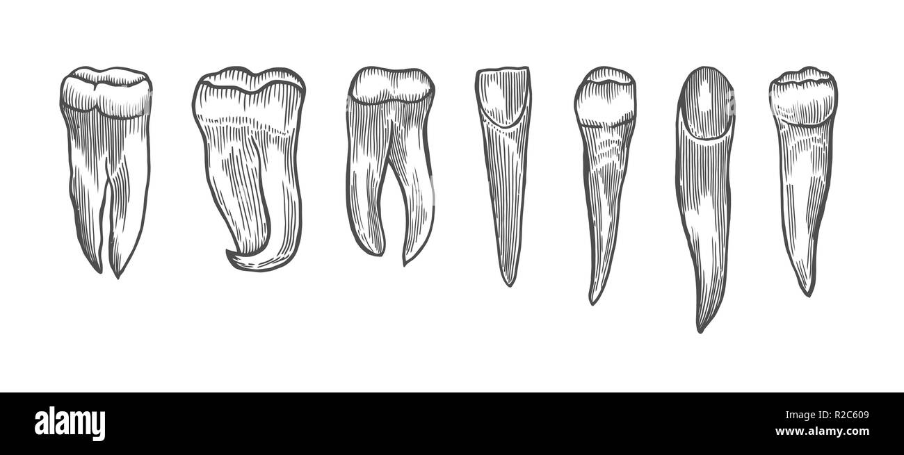 Engraving vintage tooth set. Hand drawn illustration isolated on white ...