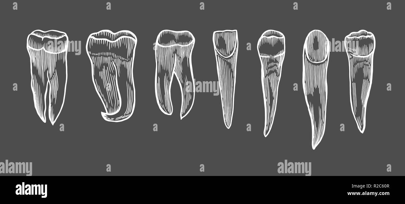 Engraving vintage tooth set. Hand drawn illustration isolated on black ...