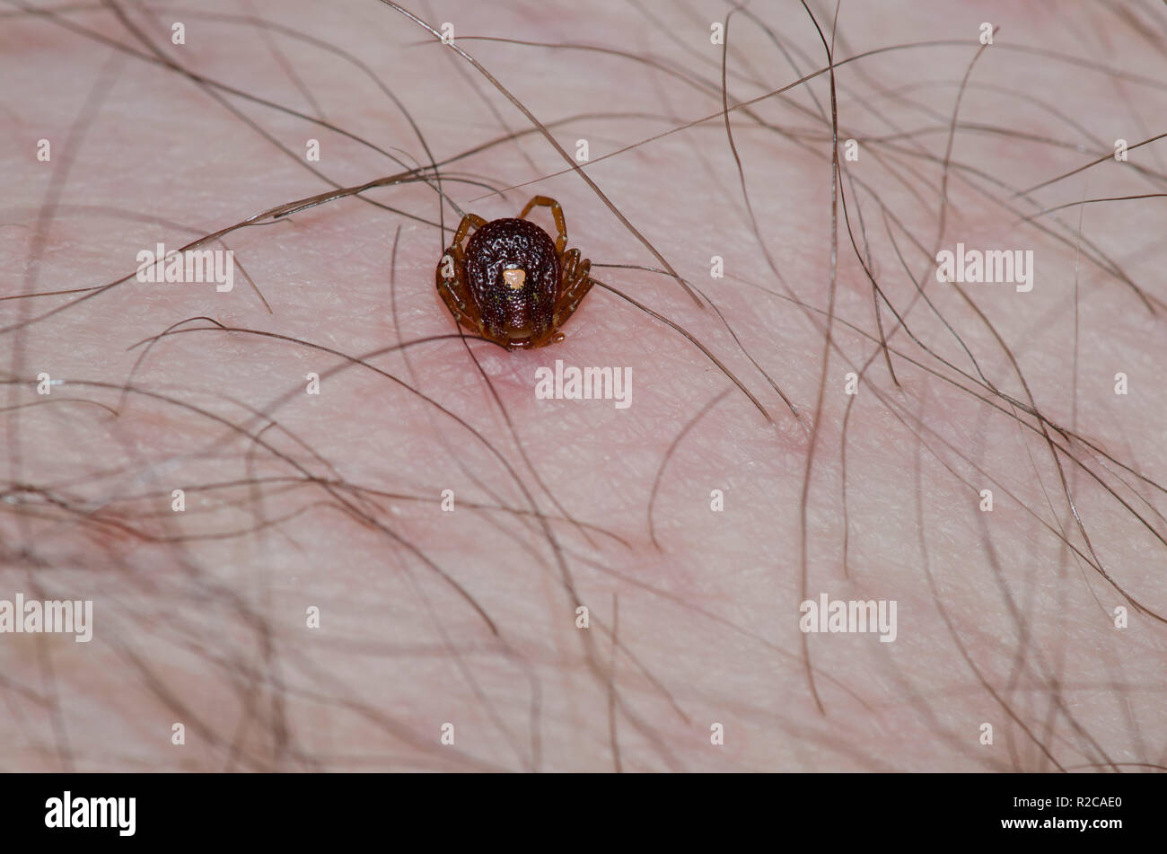 Attached tick hi-res stock photography and images - Alamy