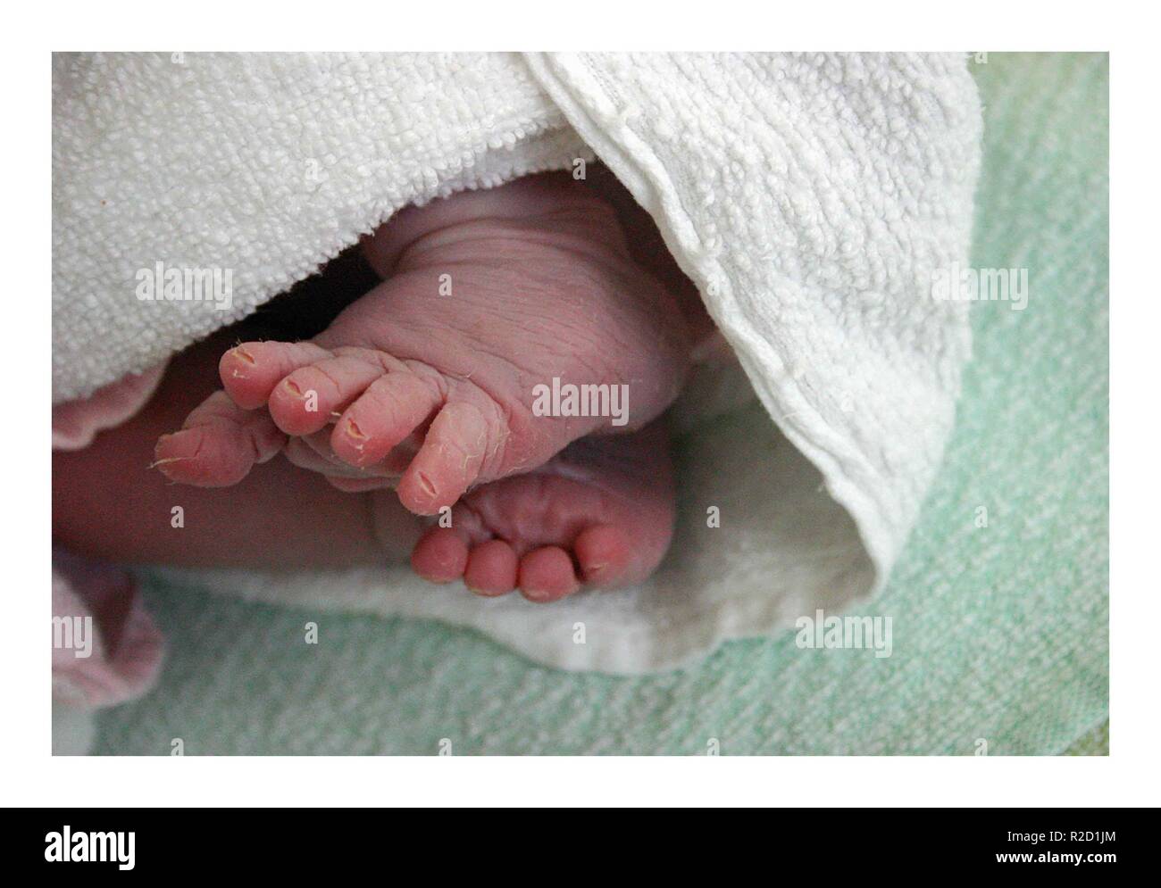Baby foot skin Cut Out Stock Images & Pictures - Alamy